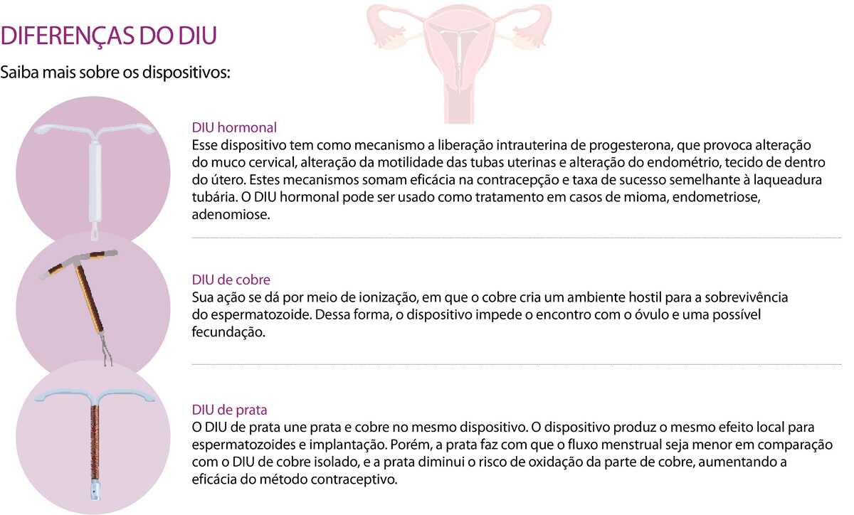 Com menos dosagens de hormônio, DIU volta a ser centro das atenções ...